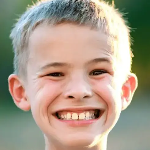 Dental Fillings For Kids El Paso TX - Smile Center For Kids